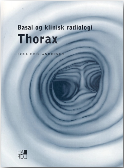 Basal og klinisk radiologi – Thorax – Boganmelderne